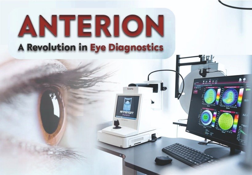 What is the unique feature of ANTERION? - Best eye specialist Hospital ...